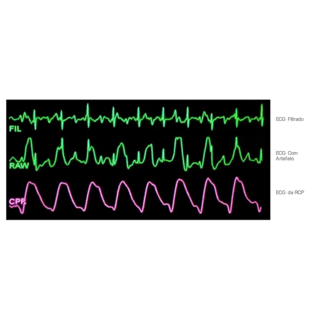 Cardioversor X Series®, até 2x mais leve que outros monitores conhecidos