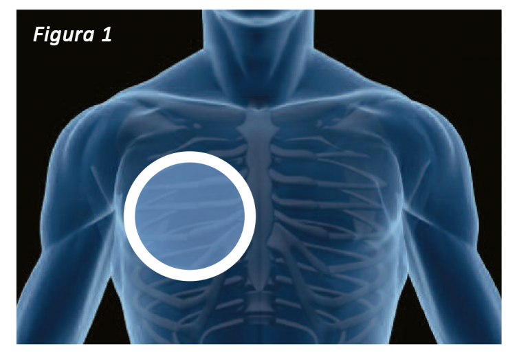 Dicas para uma cardioversão bem sucedida - Indumed