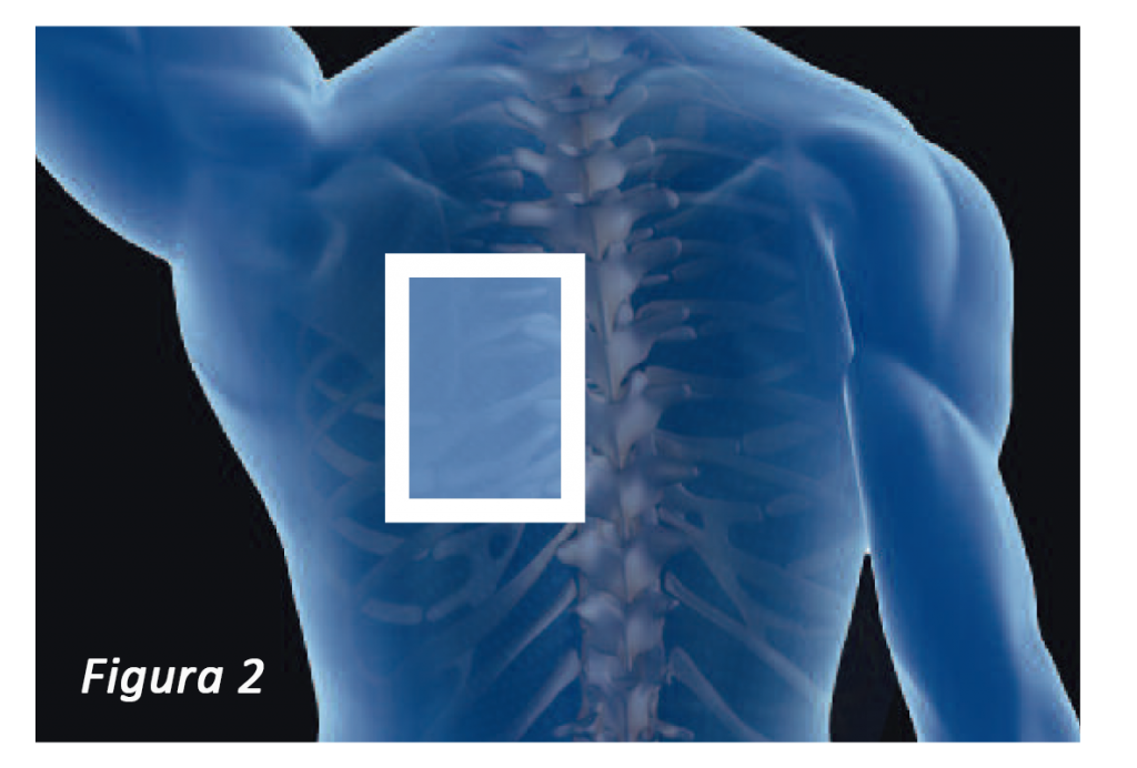 Dicas para uma cardioversão bem sucedida - Indumed