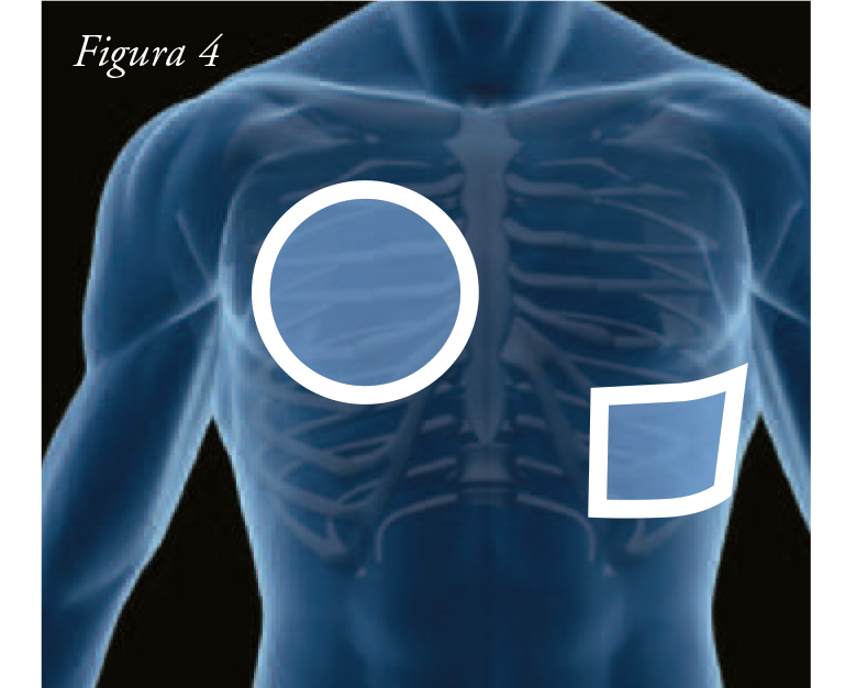 Dicas para uma cardioversão bem sucedida - Indumed
